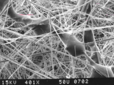 Solving Common Genset Battery Failure Issues | SENS